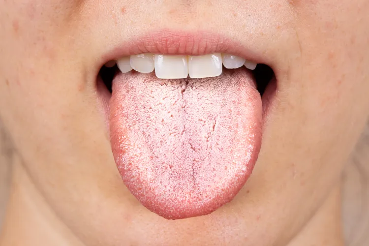 AI Tongue Analysis Predicts Diseases with 98% Accuracy